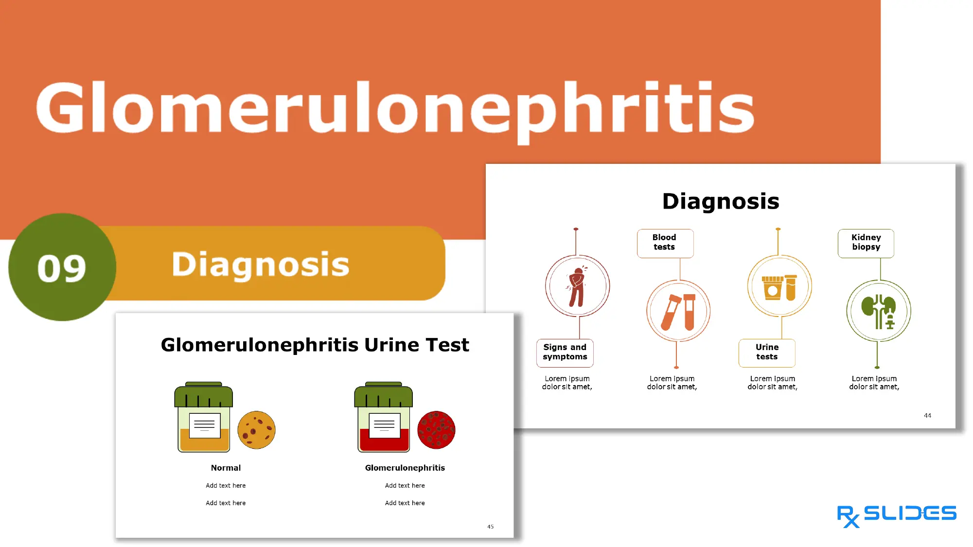 Download Glomerulonephritis PowerPoint Template| RxSlides